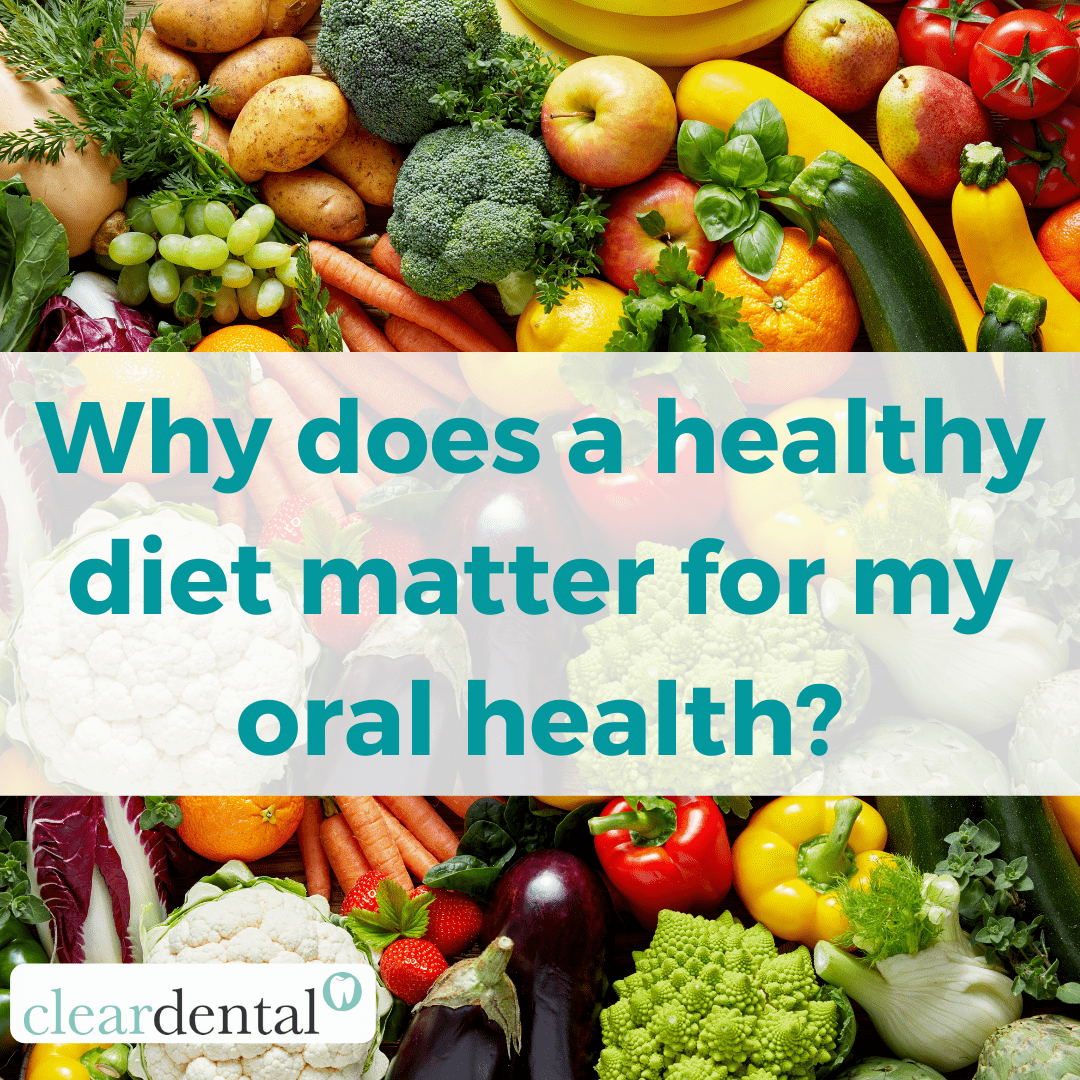 Blog – Page 4 – Clear Dental